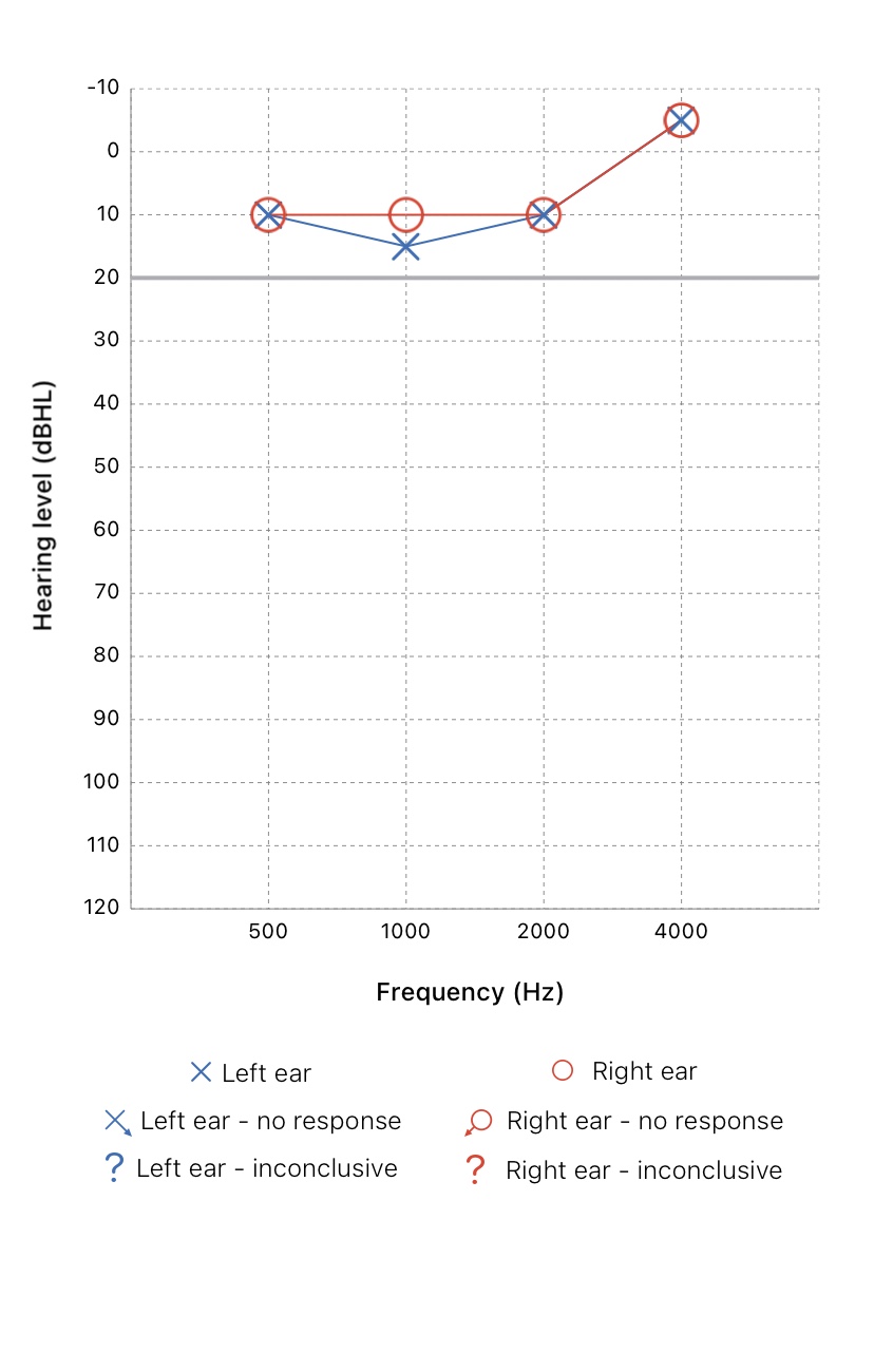 Hearing Tests – DNM Health